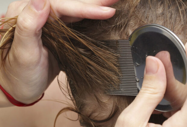 Things to Know About Head Lice
