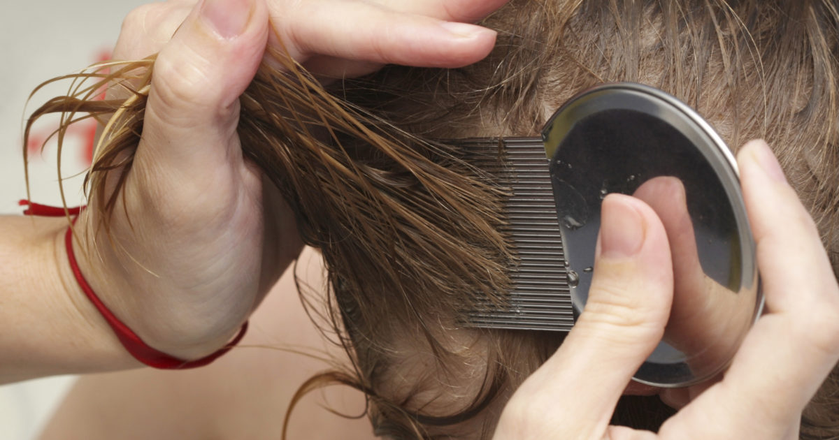 Things to Know About Head Lice
